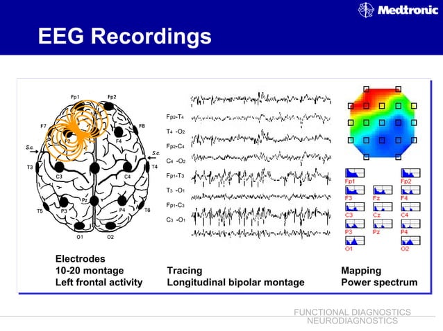 EEG ~ Dr. Tarek Asaad | PPT