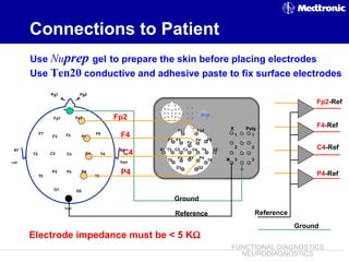 EEG ~ Dr. Tarek Asaad | PPT