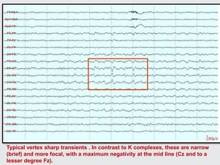 Eeg | PPT