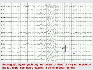 Eeg | PPT