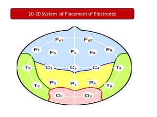 Electroencephalogram | PPTX
