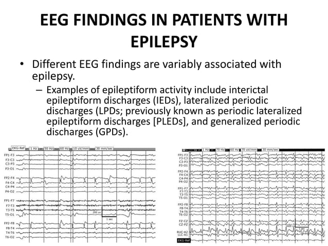 Eeg basics, part 1 | PPT