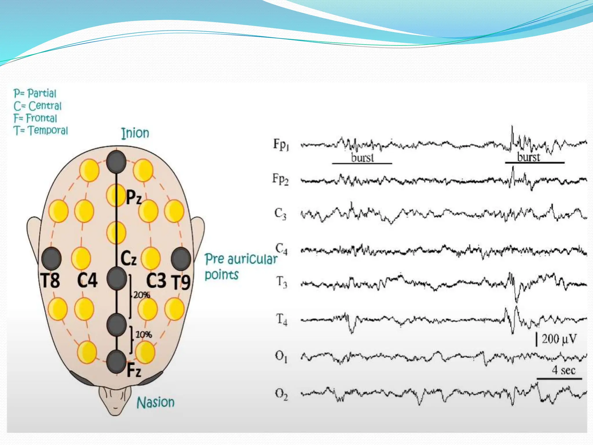 Electro encephalo graphy (EEG) Lecture.pptx