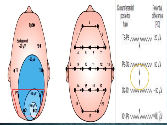 EEG basic to practice 1