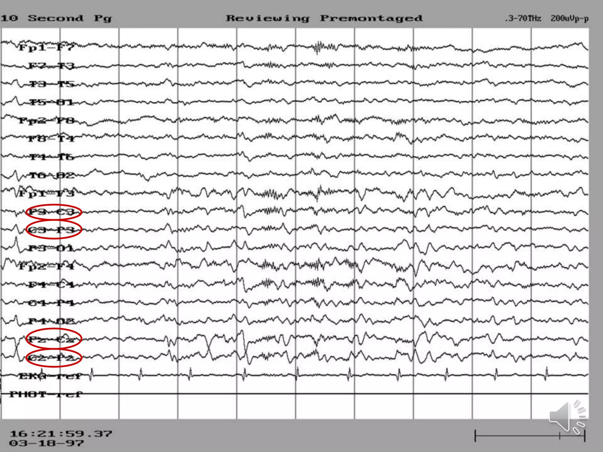 EEG basic to practice 2 | PPT