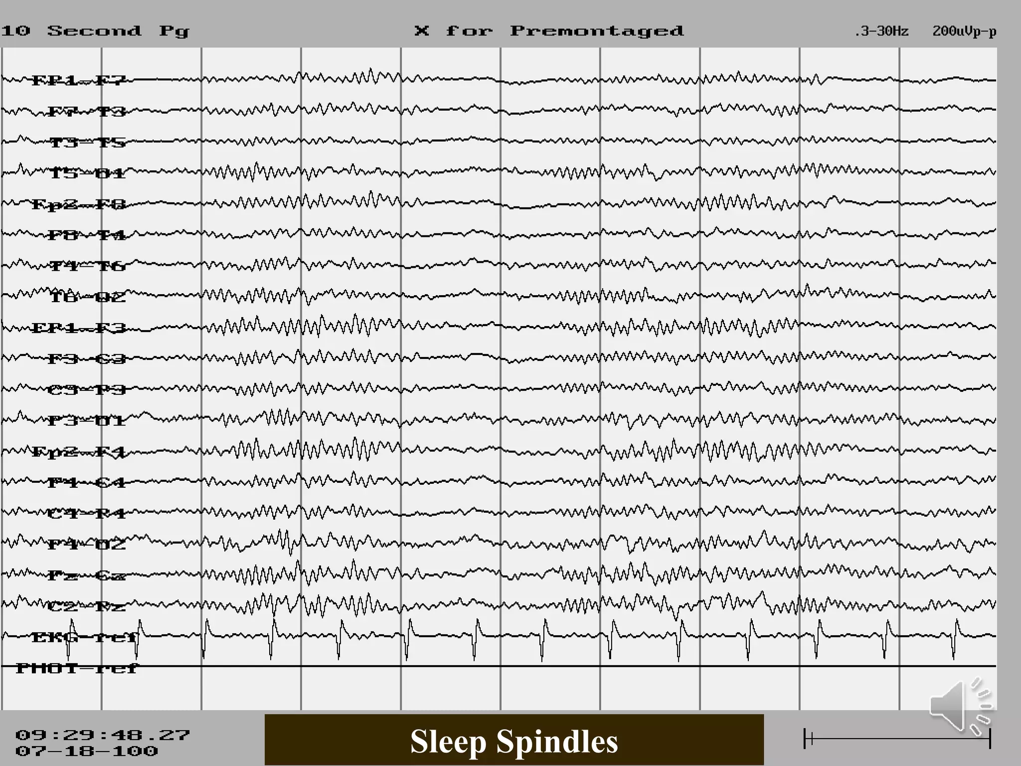 EEG basic to practice 2 | PPT