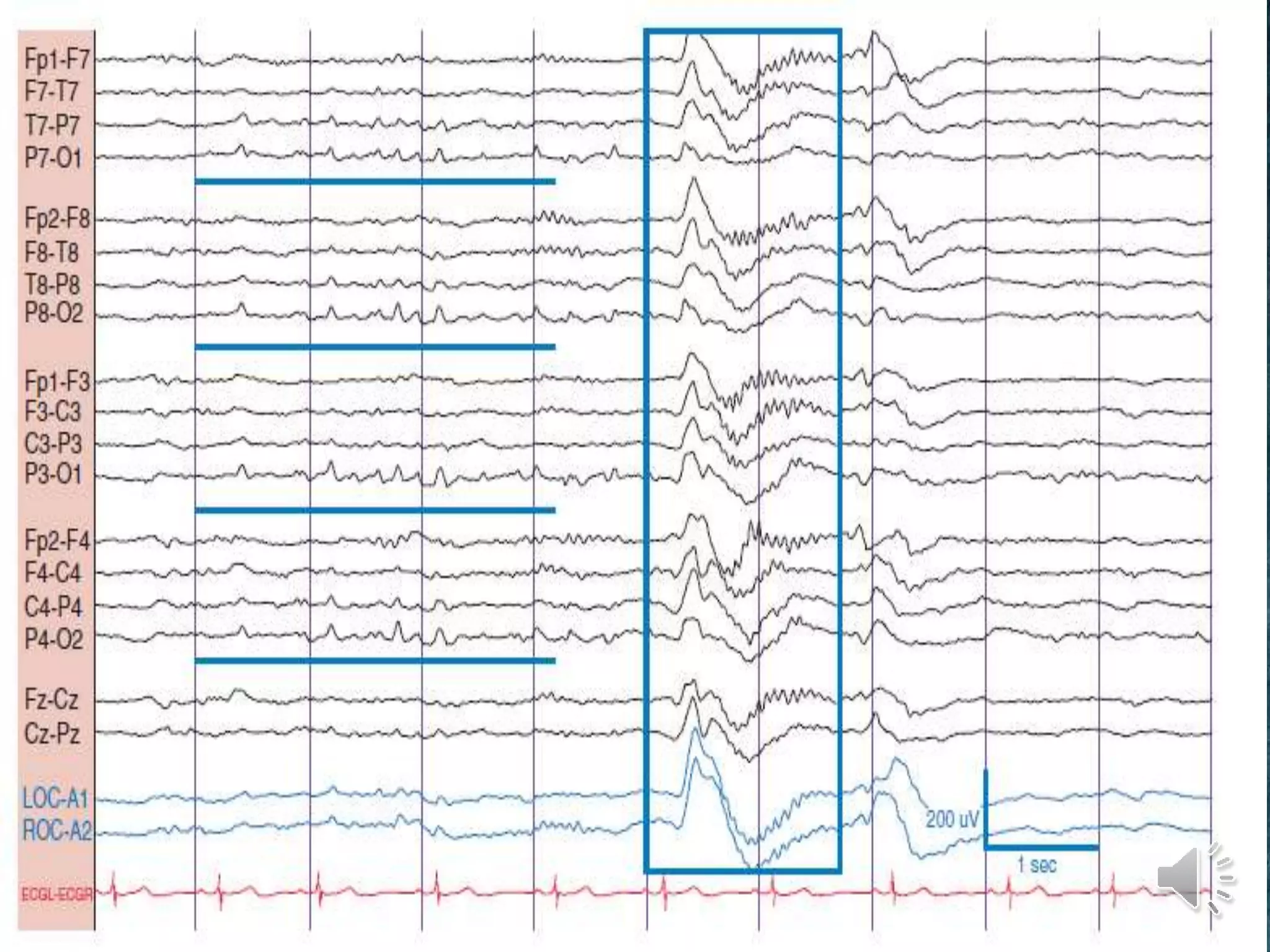 EEG basic to practice 2 | PPT