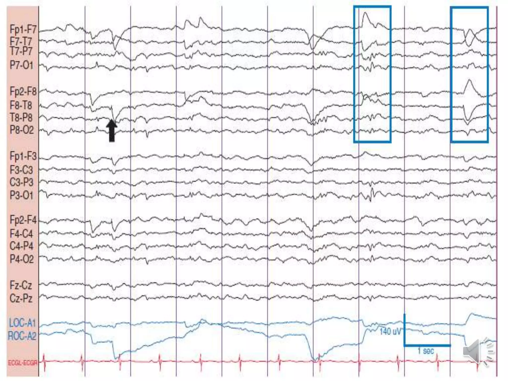 EEG basic to practice 2 | PPT