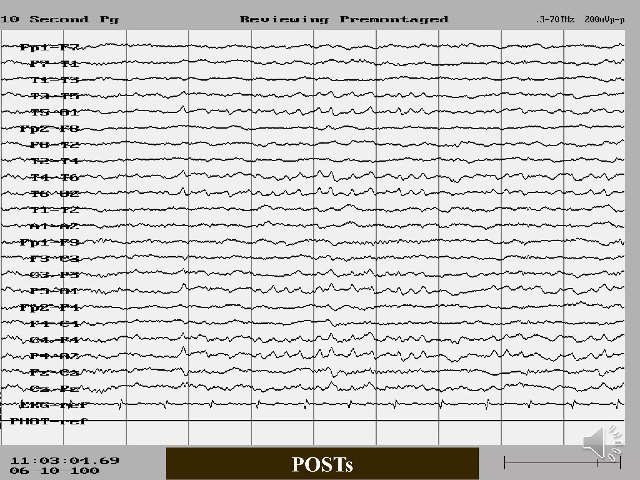 EEG basic to practice 2 | PPT