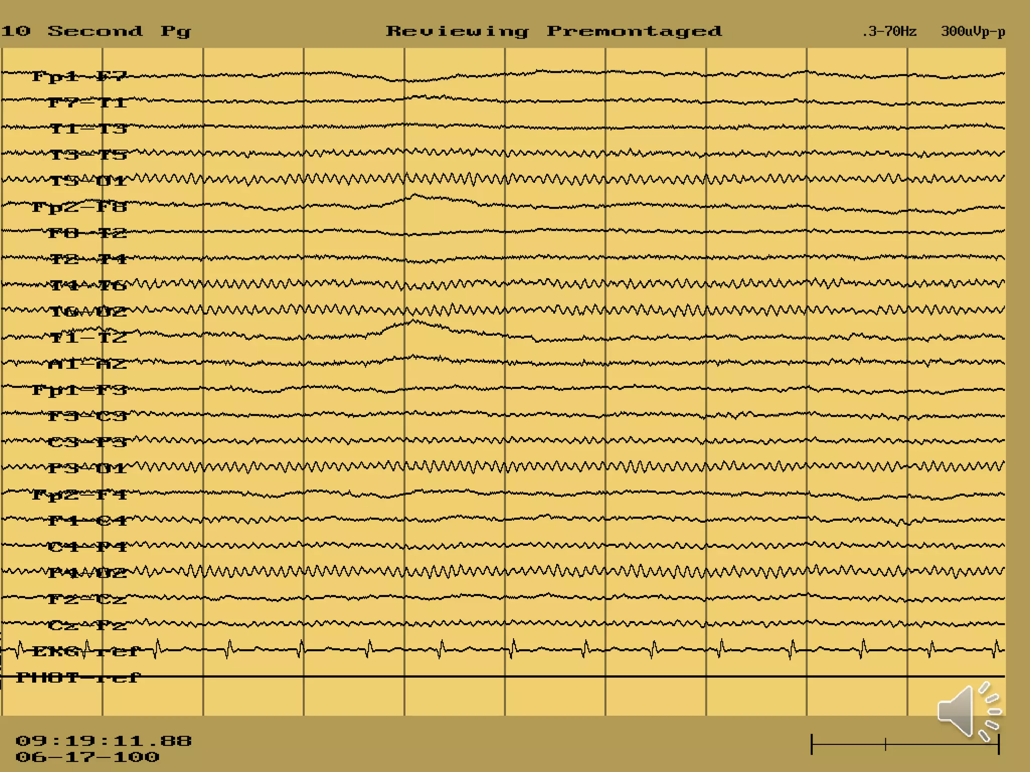EEG basic to practice 2 | PPTX