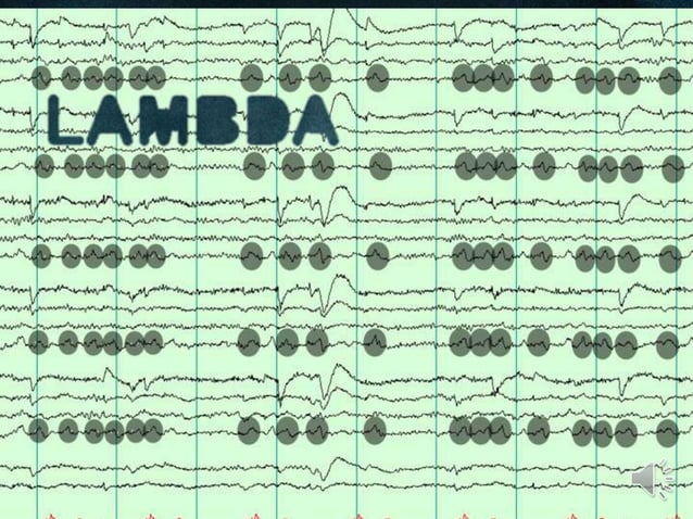 EEG basic to practice 2 | PPT