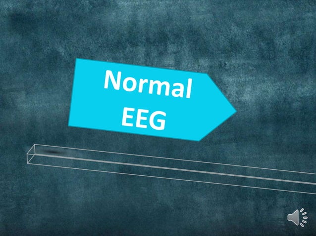 EEG basic to practice 2 | PPT