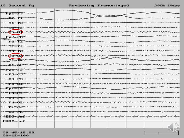 EEG basic to practice 2 | PPT