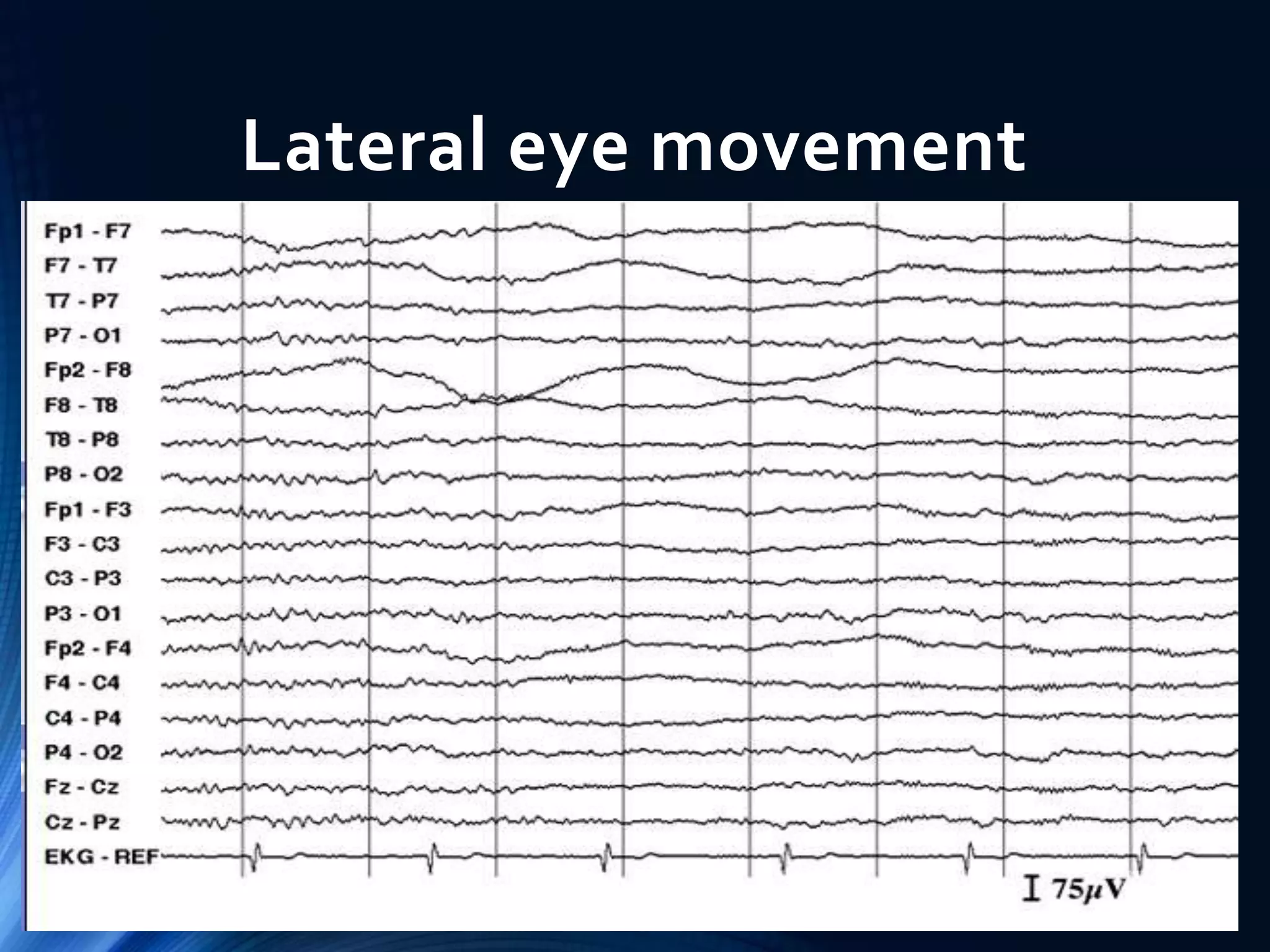 EEG of Children and Sleep | PPTX