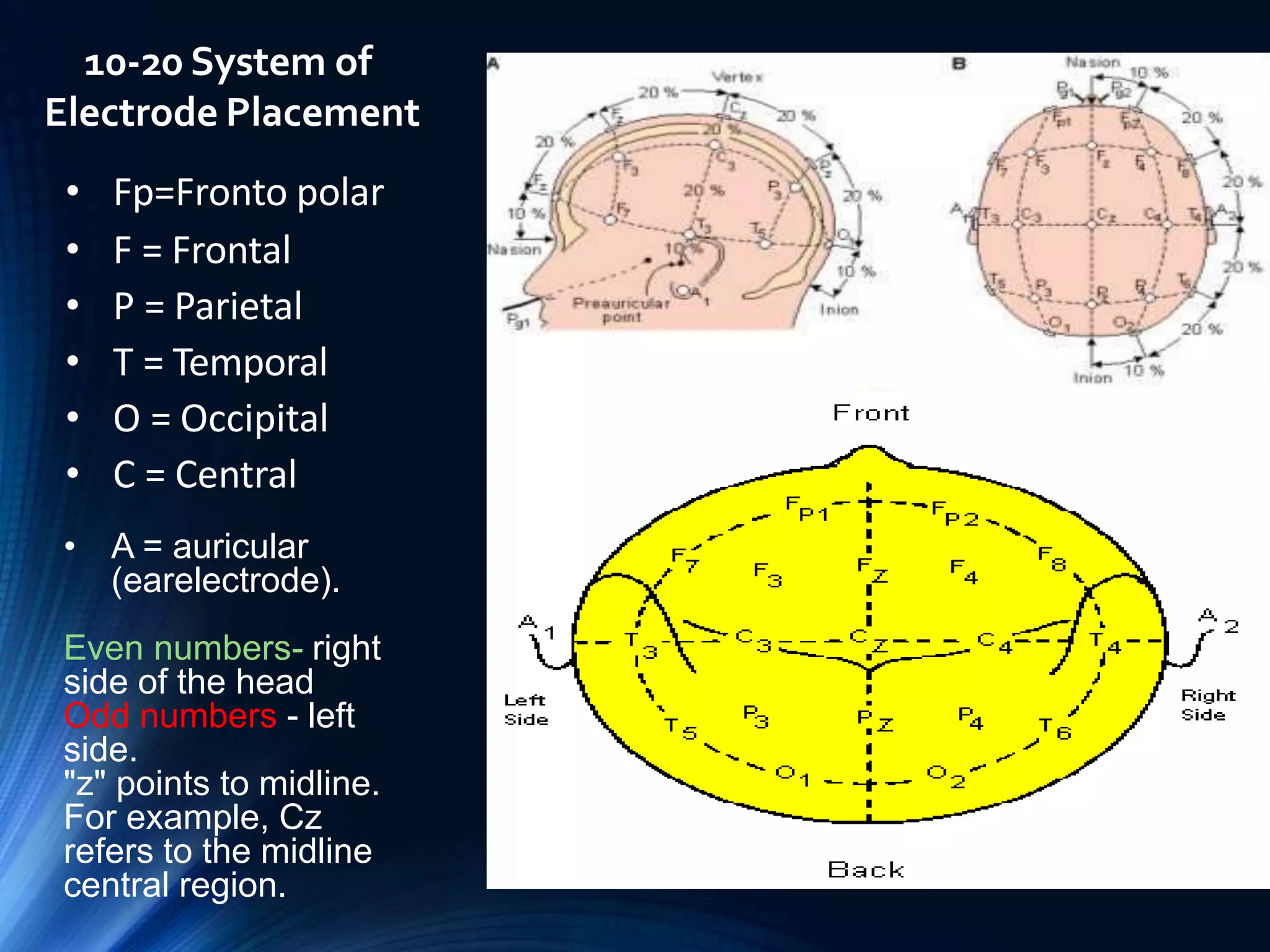 EEG of Children and Sleep | PPTX