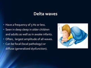 EEG of Children and Sleep | PPTX