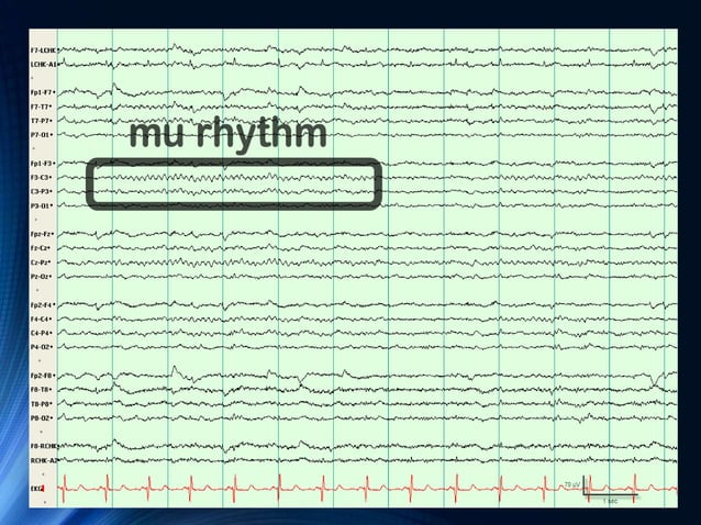 EEG of Children and Sleep | PPTX | Parenting Babies and Toddlers ...