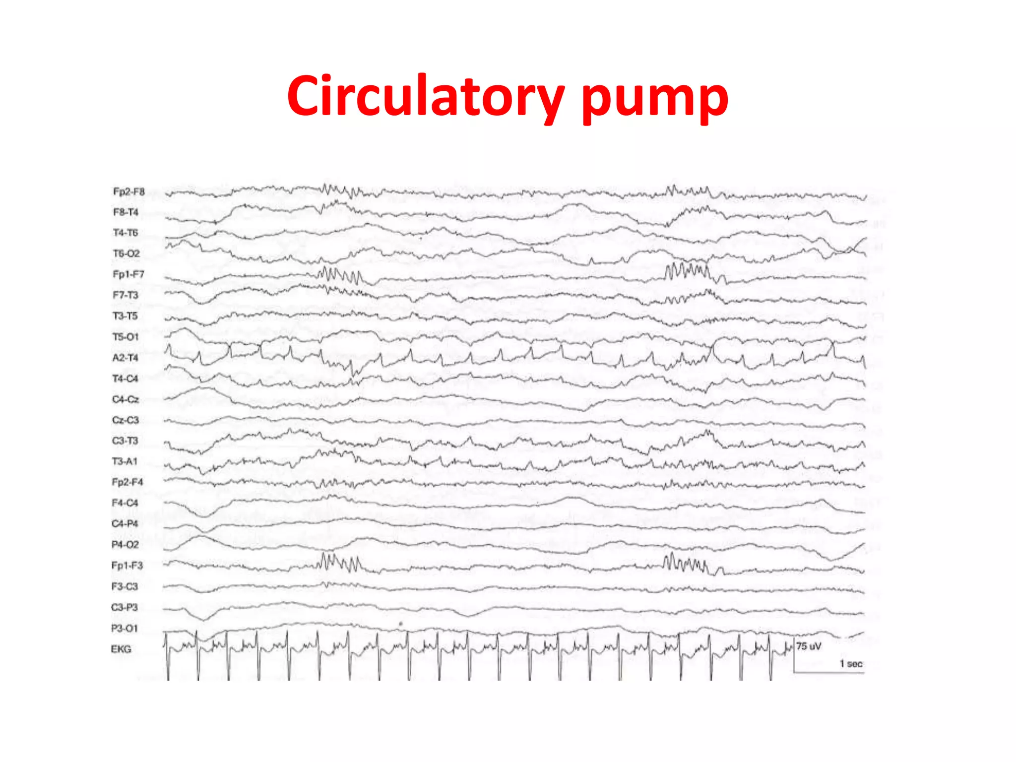 Eeg Artifacts Pptx