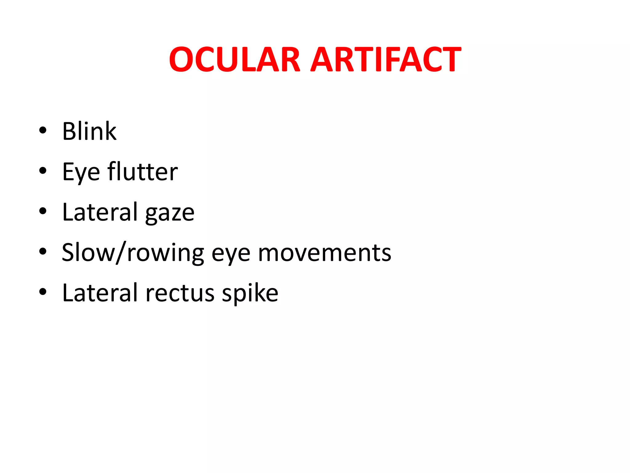 EEG artifacts | PPTX