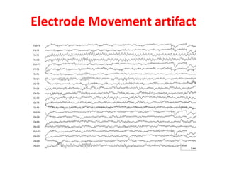 EEG artifacts | PPTX