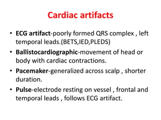EEG artifacts | PPTX
