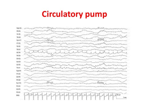EEG artifacts