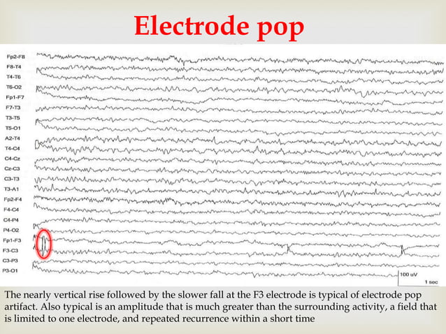 EEG artifacts | PPTX