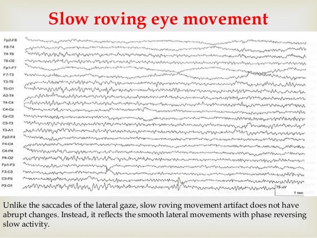 EEG artifacts