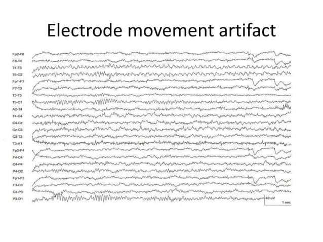 Eeg artifacts | PPTX | Science