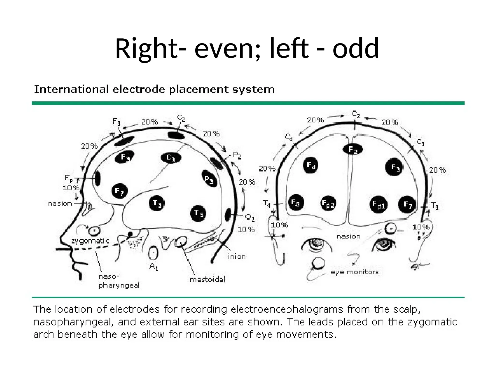 EEG interpretation for healthcare workers.ppt