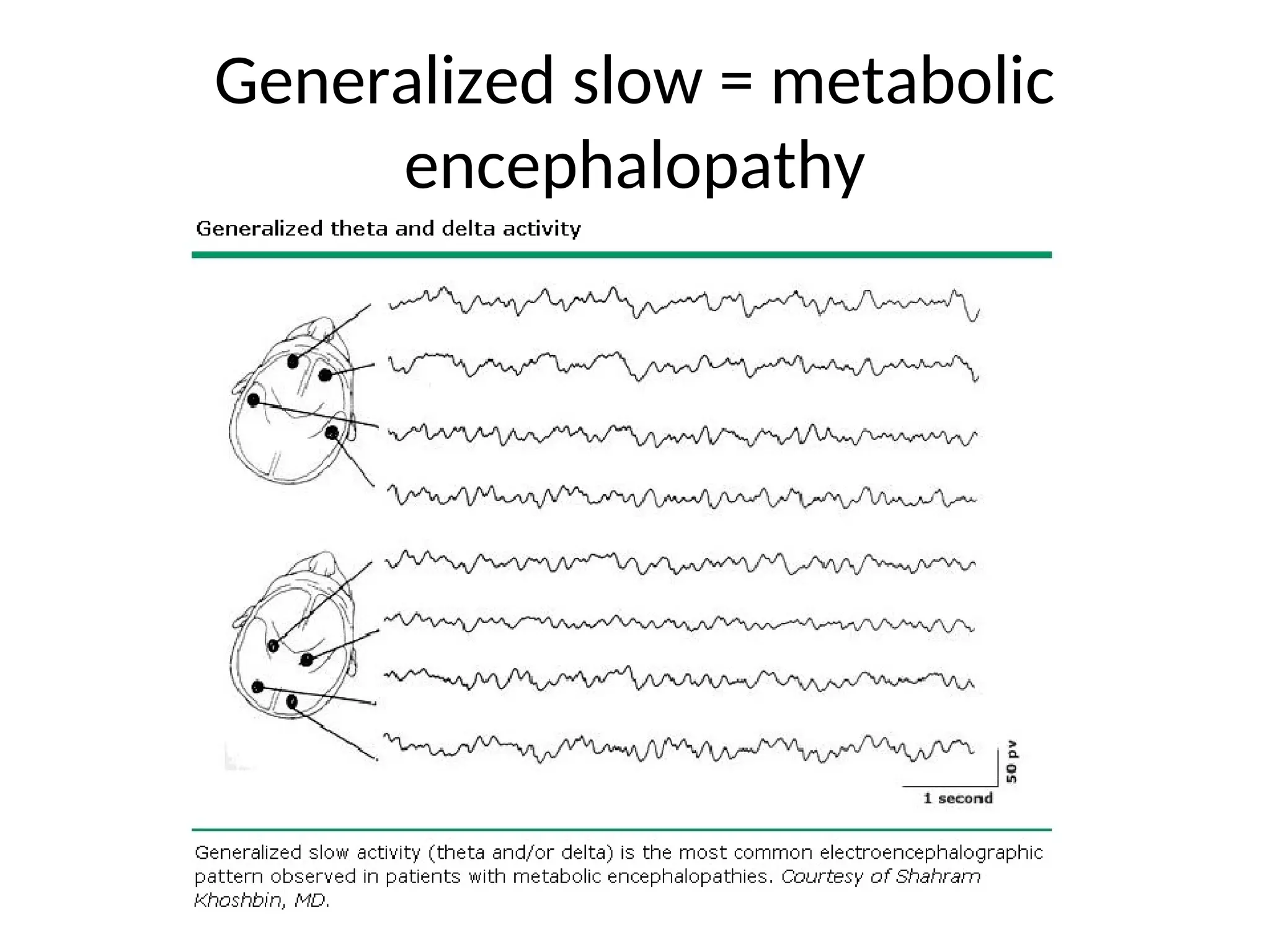 EEG interpretation for healthcare workers.ppt