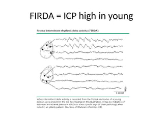 EEG interpretation for healthcare workers.ppt
