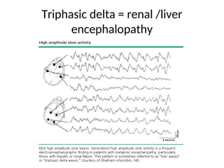 EEG interpretation for healthcare workers.ppt
