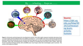 EEG basics for mental health professionals | PPT