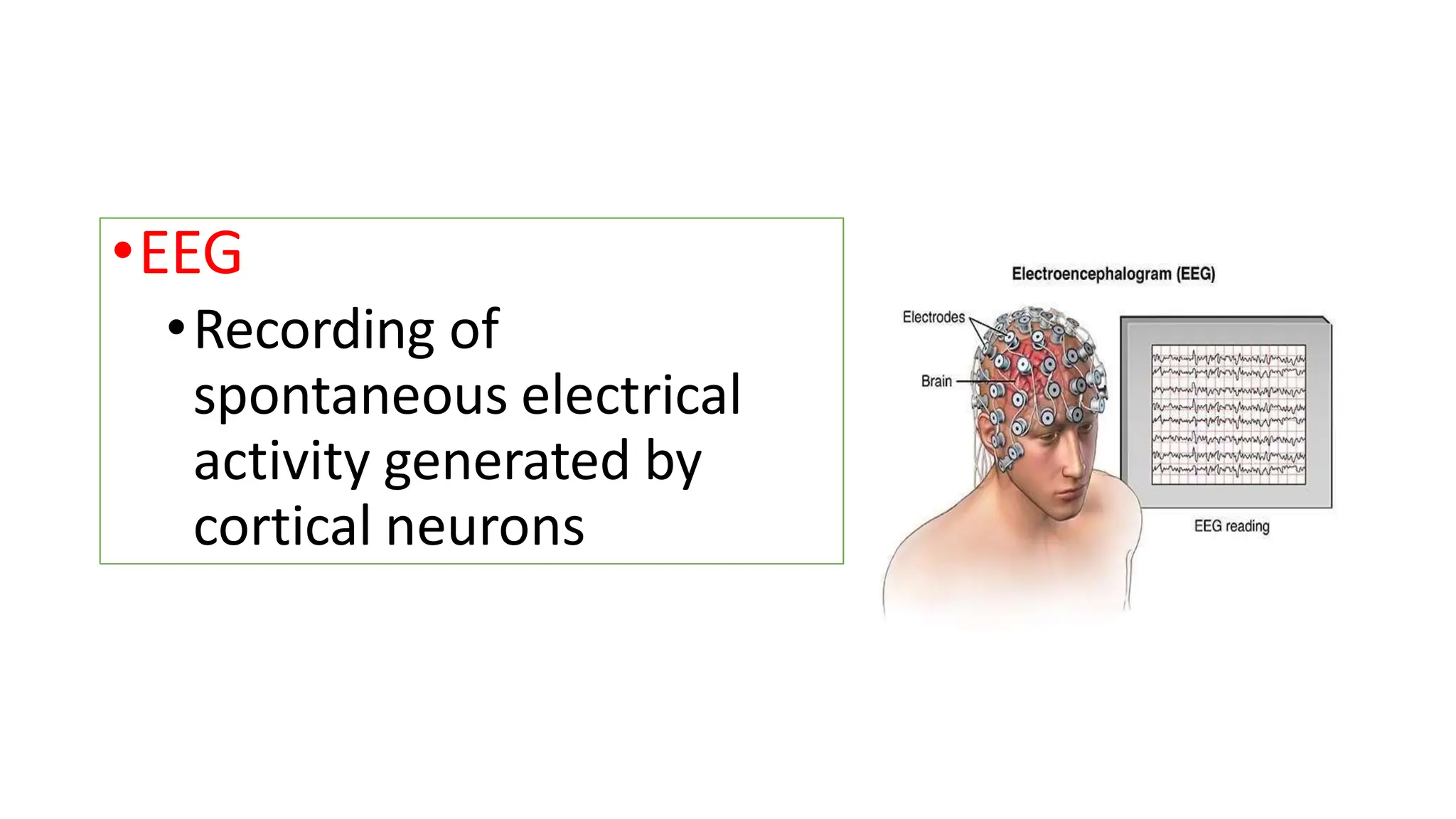 EEG Basics monish.pptx