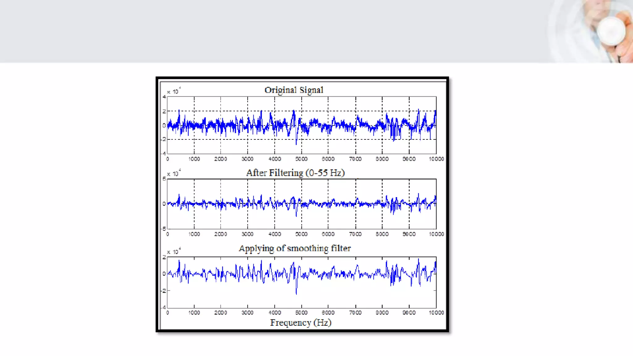 EEG (ELECTROENCEPALOGRAM) | PPTX