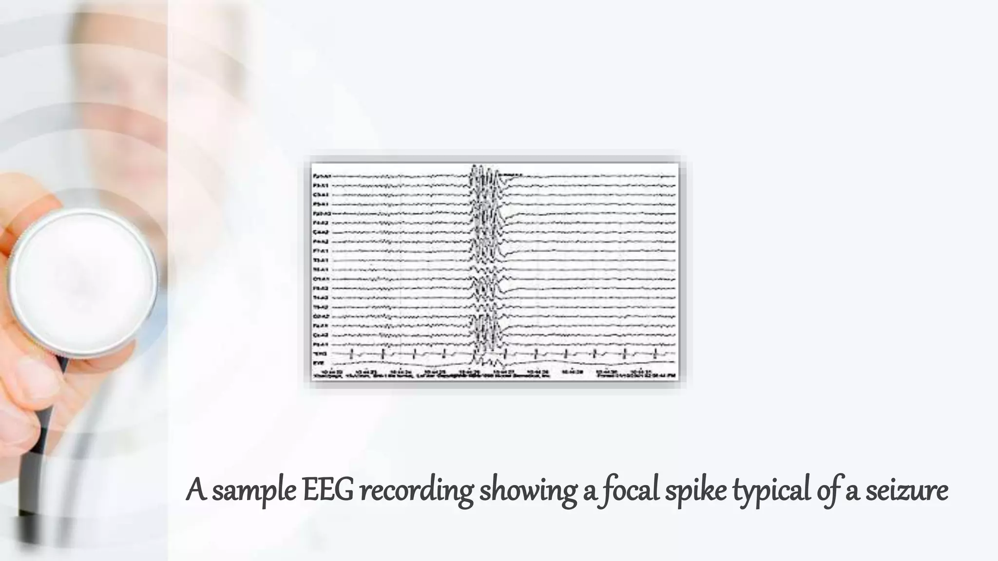 EEG (ELECTROENCEPALOGRAM) | PPTX