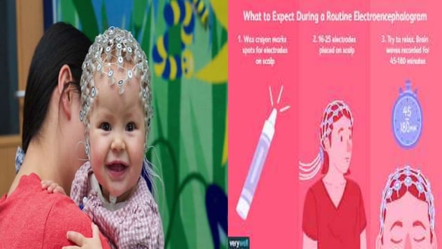 EEG (ELECTROENCEPALOGRAM) | PPTX | Digital Audio | Computer Software ...