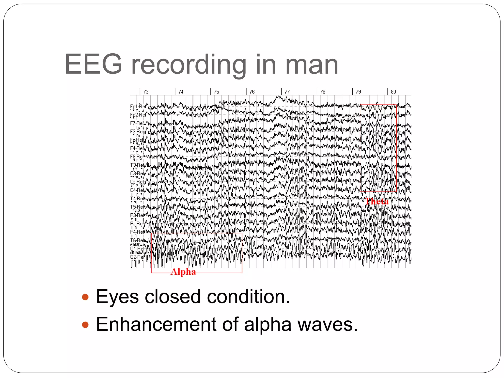 EEG_circuit.ppt
