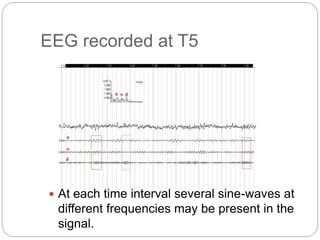 EEG_circuit.ppt