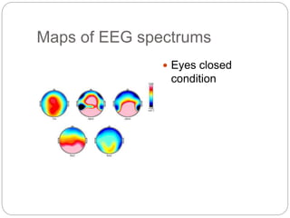 EEG_circuit.ppt