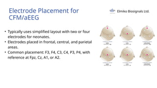 EEGDigiTrack aEEGCFM Elmiko Biosignals Ltd..pptx