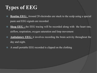 Eeg & ecg | PPTX