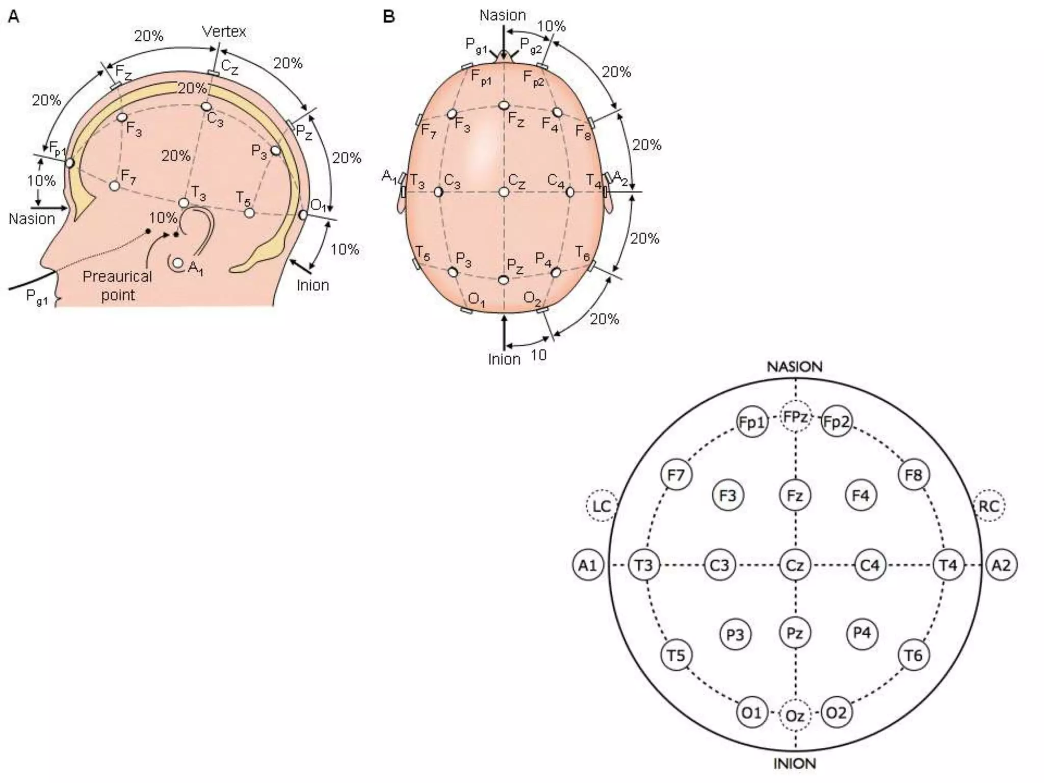 Eeg (electroencephalo | PPTX