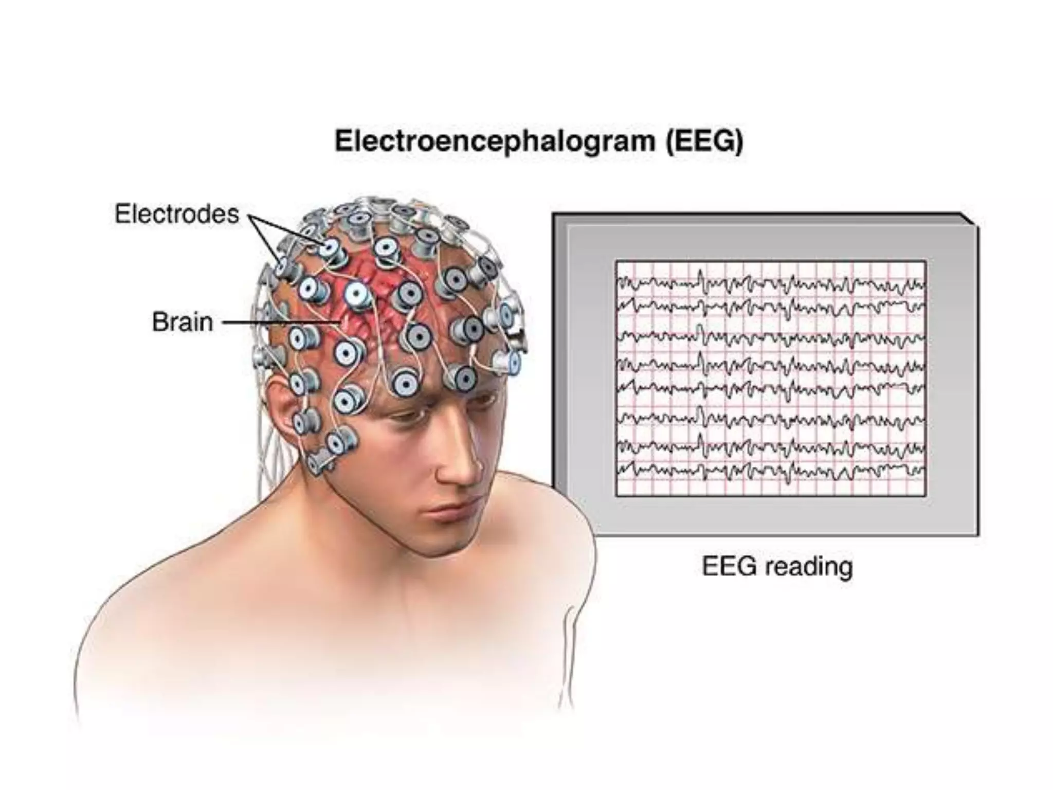 Eeg (electroencephalo | PPTX