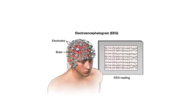 Electroencephalogram Eeg Uses Procedure Results