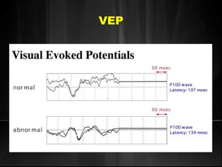 EEG & Evoked potentials | PPTX