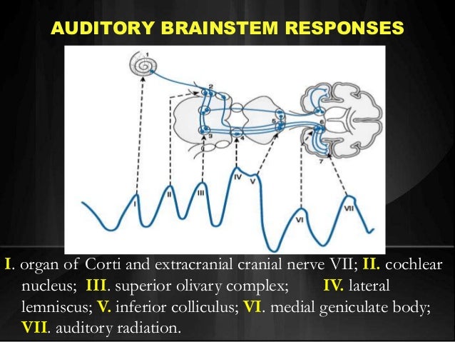 EEG & Evoked potentials