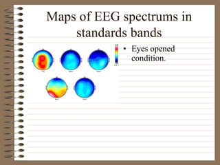 Eeg examples | PPT
