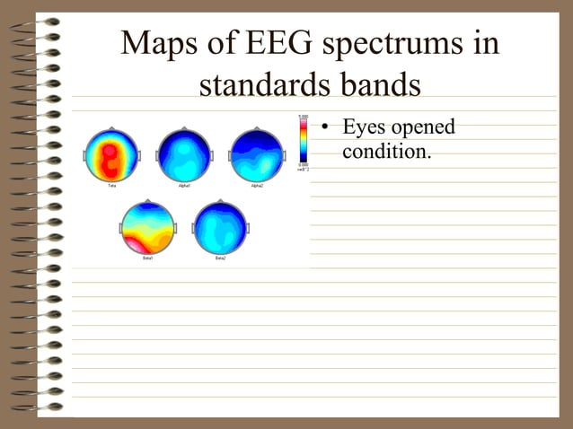 Eeg examples | PPT
